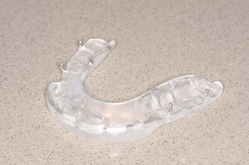 La plaque occlusale | Centre dentaire St-Onge